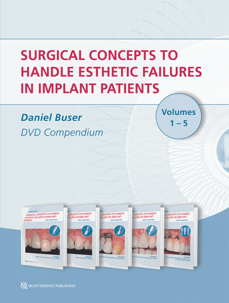 Surgical concepts to handle esthetic failures in implant patients ...
